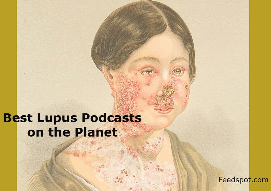 15 Best Lupus Podcasts to Listen to in 2026